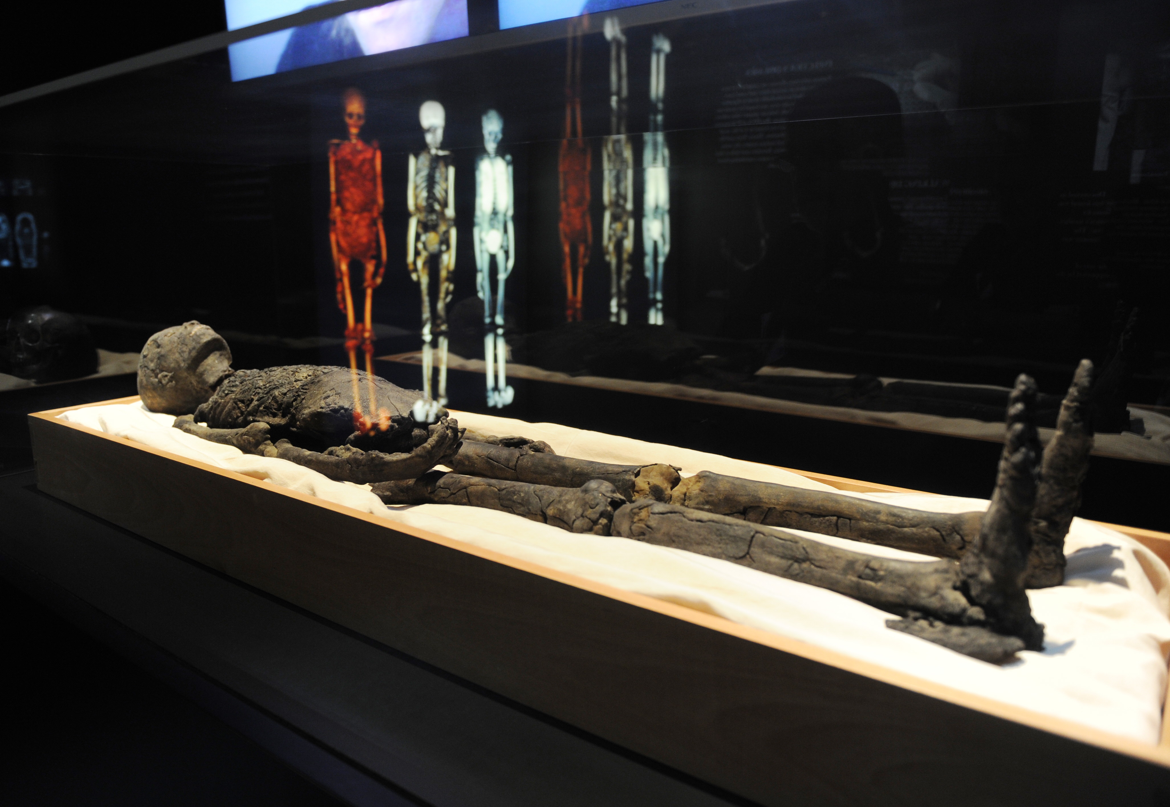 Oldest prosthetic ever found on Egyptian mummy - The World from PRX
