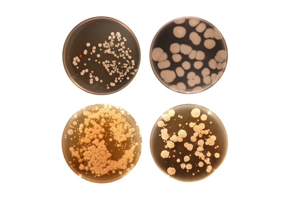 Belly button bacteria: What's living in your navel? - The World from PRX