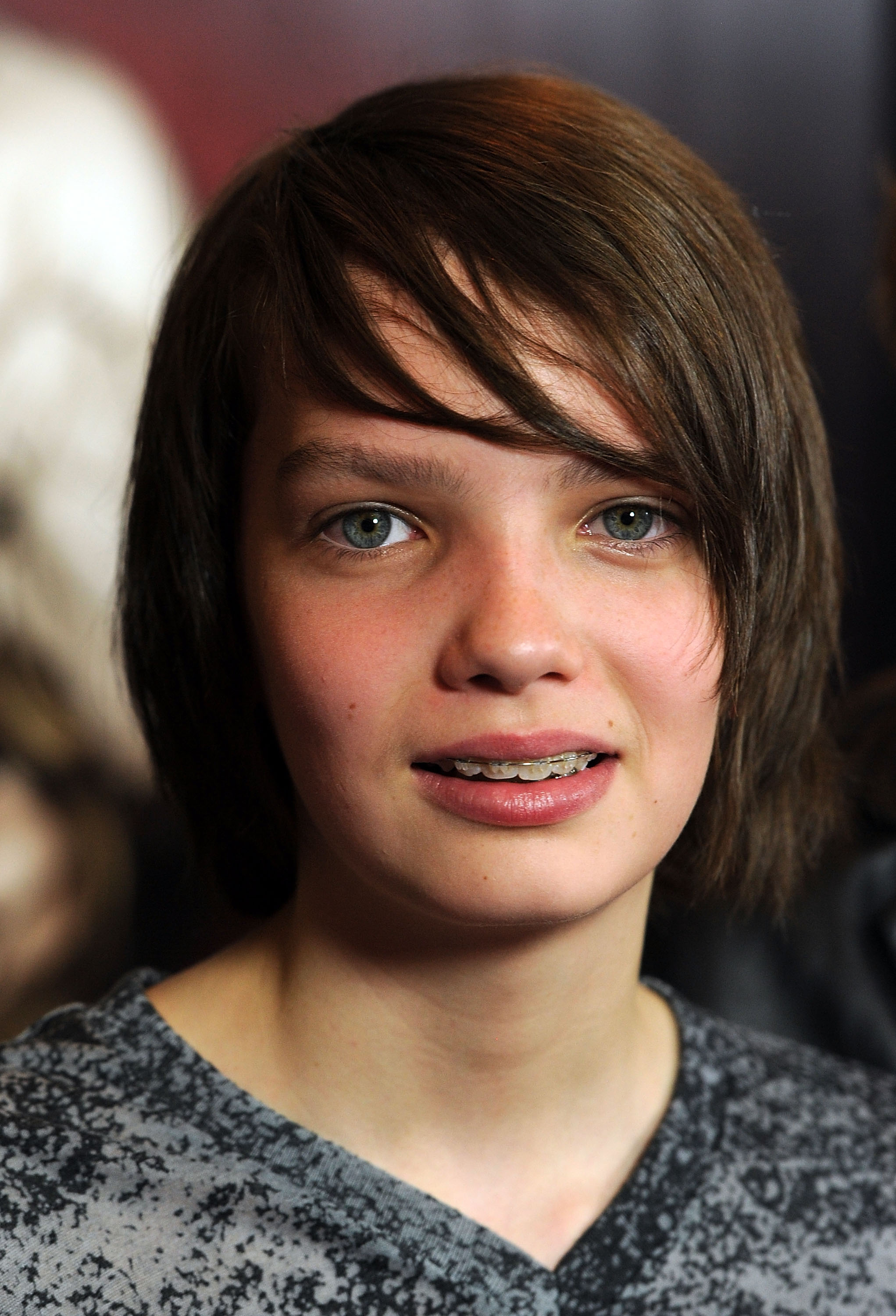 Fake Braces Trend Takes Asia By Storm The World From Prx