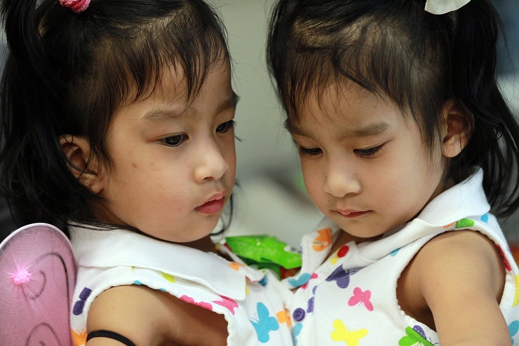 Conjoined twins separated, and survive - The World from PRX