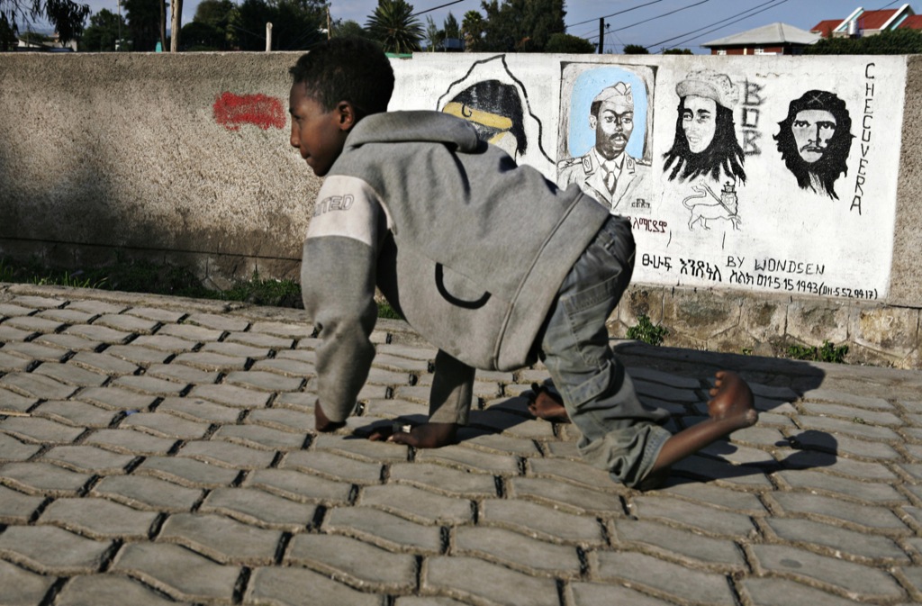 Ethiopia: NGO celebrates 50 years fighting disability - The World from PRX