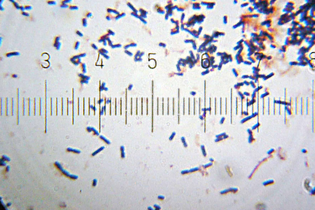 Antibiotic apocalypse is bigger threat than global warming, British ...