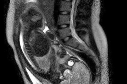 Birth of a baby captured on MRI video (VIDEO) - The World from PRX