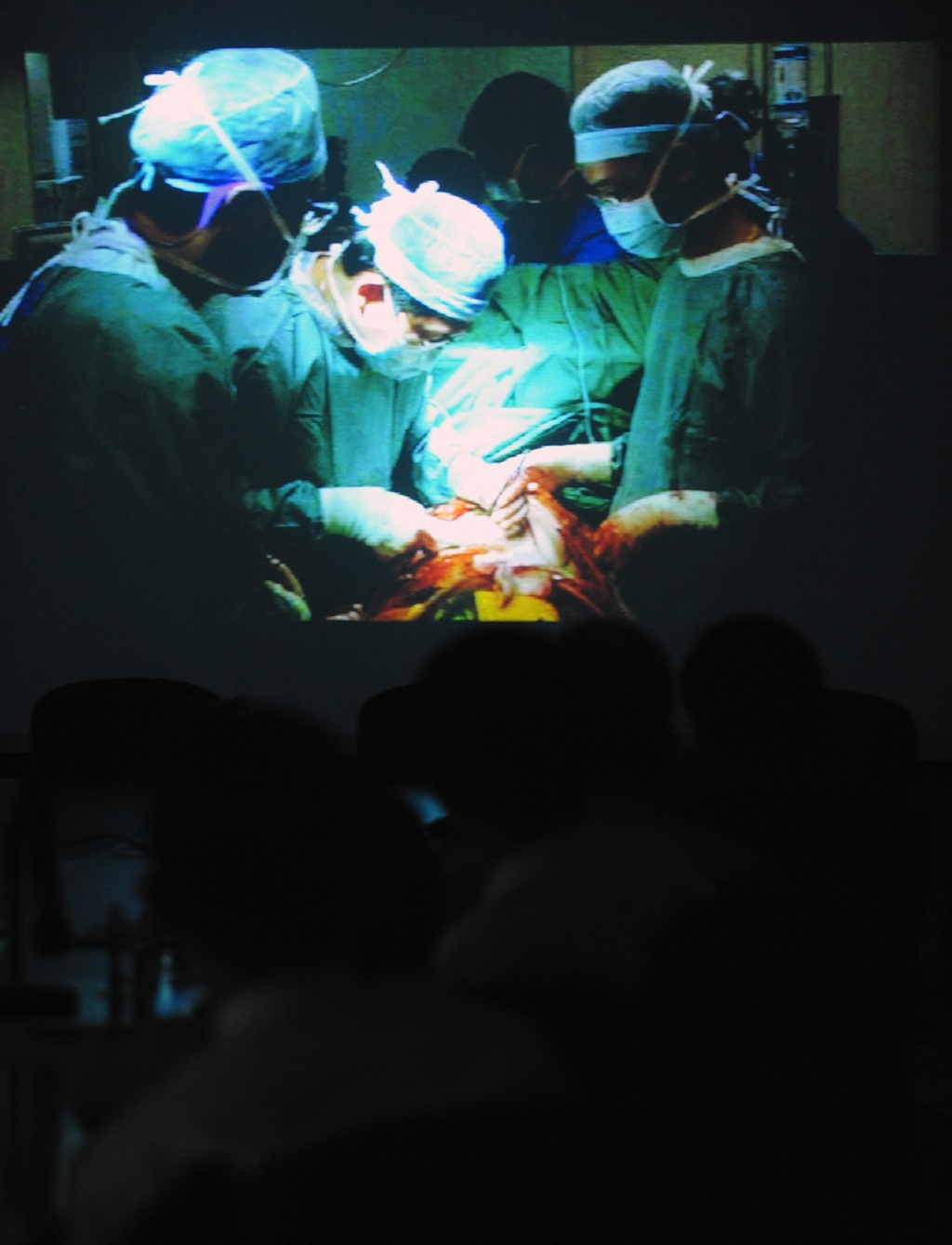Organ transplant solution contaminated with Bacillus cereus bacteria ...