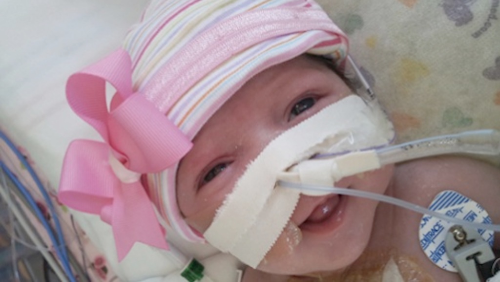 Baby born with heart outside body leaves Texas hospital - The World ...