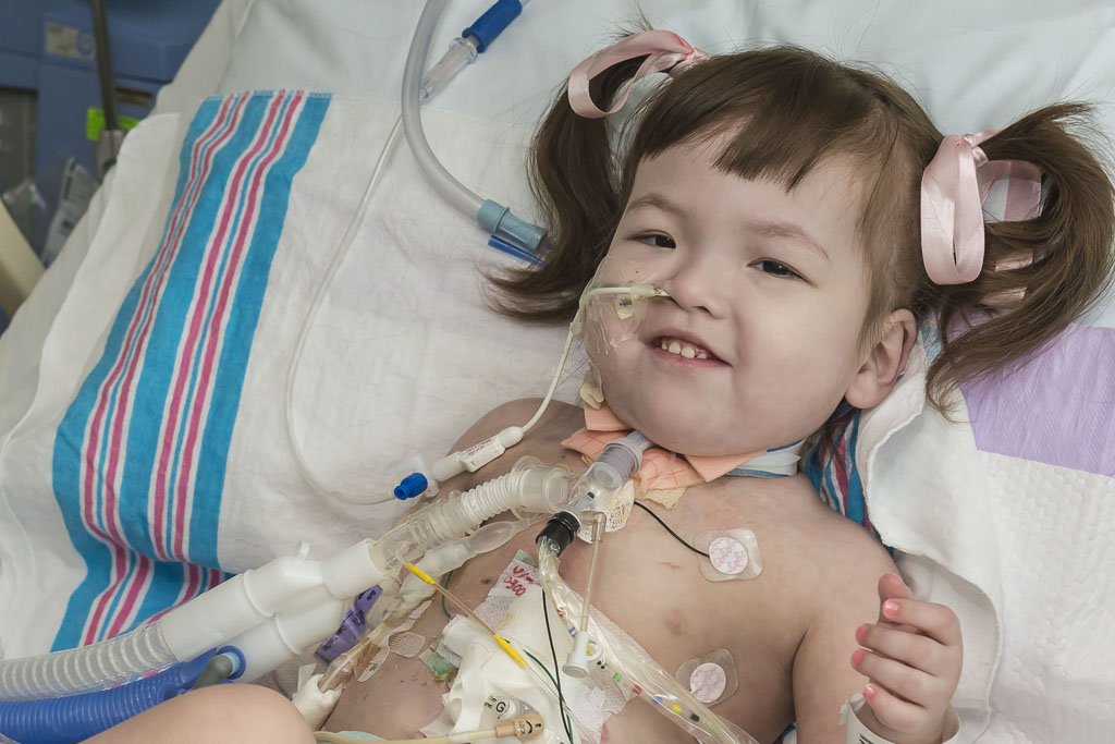 Hannah Warren, 2 1/2, alive thanks to windpipe made from stem cells ...