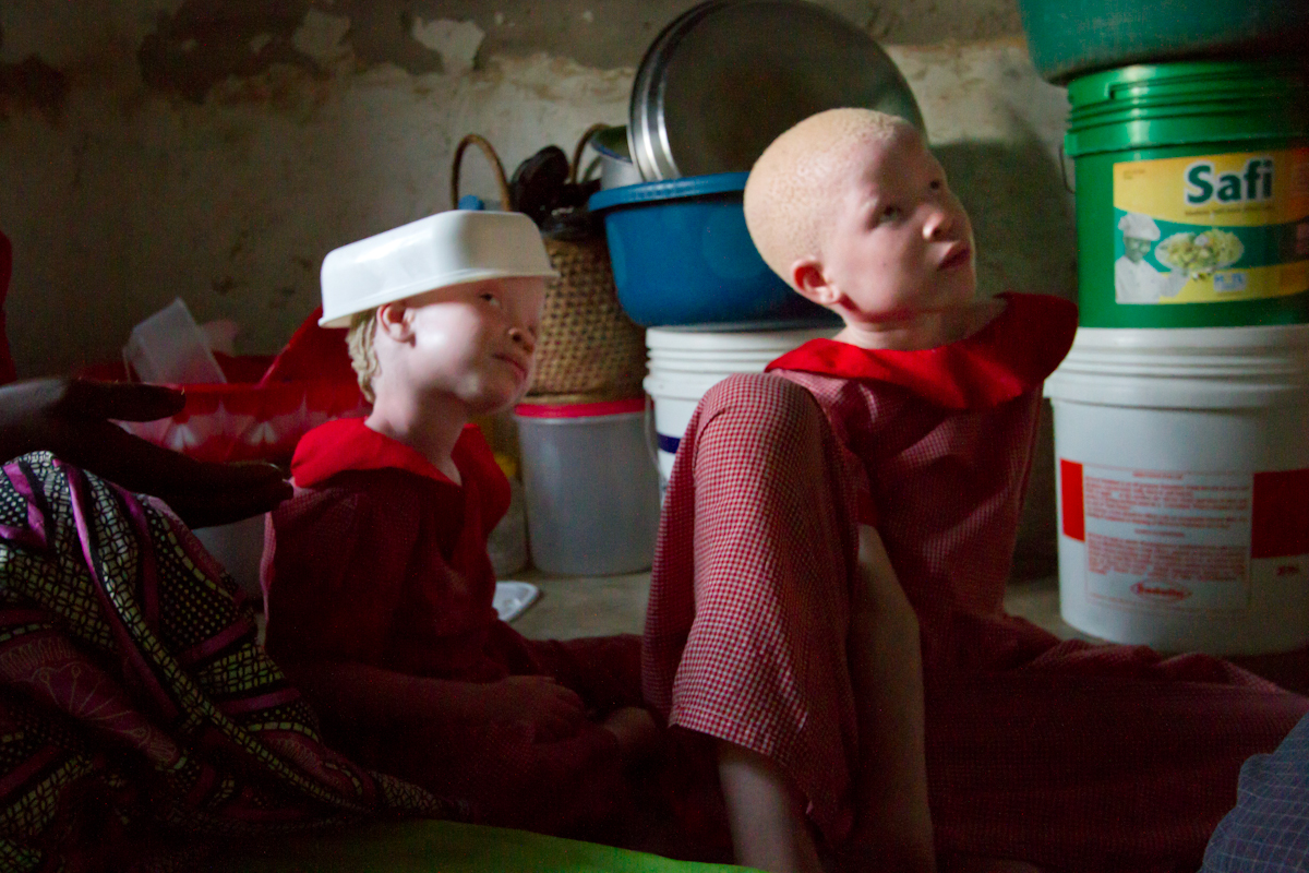 For Tanzania’s albinos, superstition leads to violence - The World from PRX