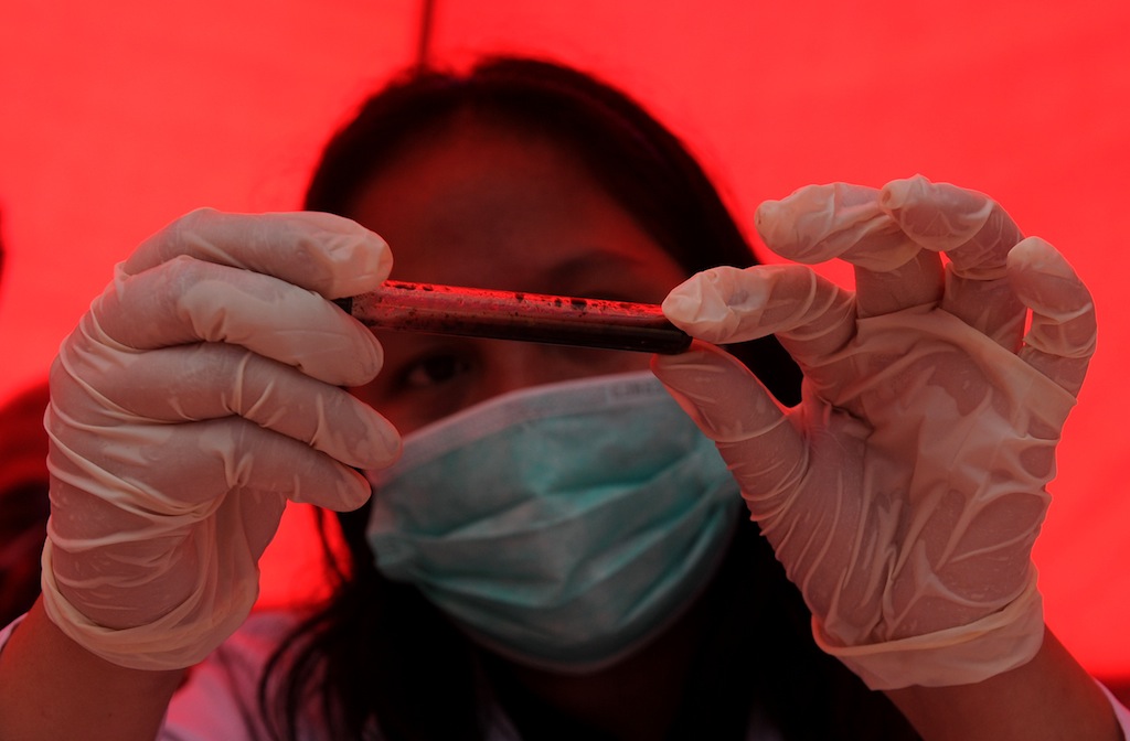 Drug-addicted mice have bad memories erased by scientists - The World ...