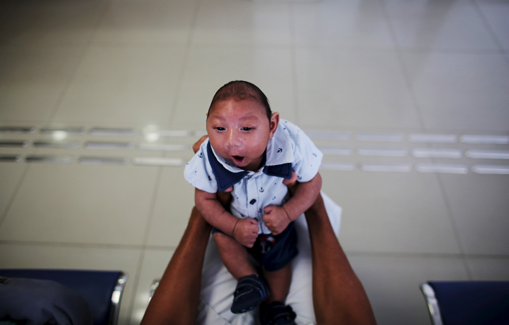 US scientists confirm Zika causes microcephaly - The World from PRX