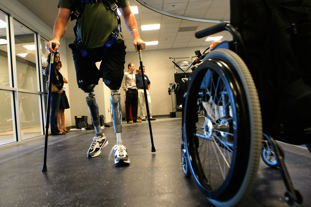 Prosthetics fused with nerves could make life-like limbs - The World ...