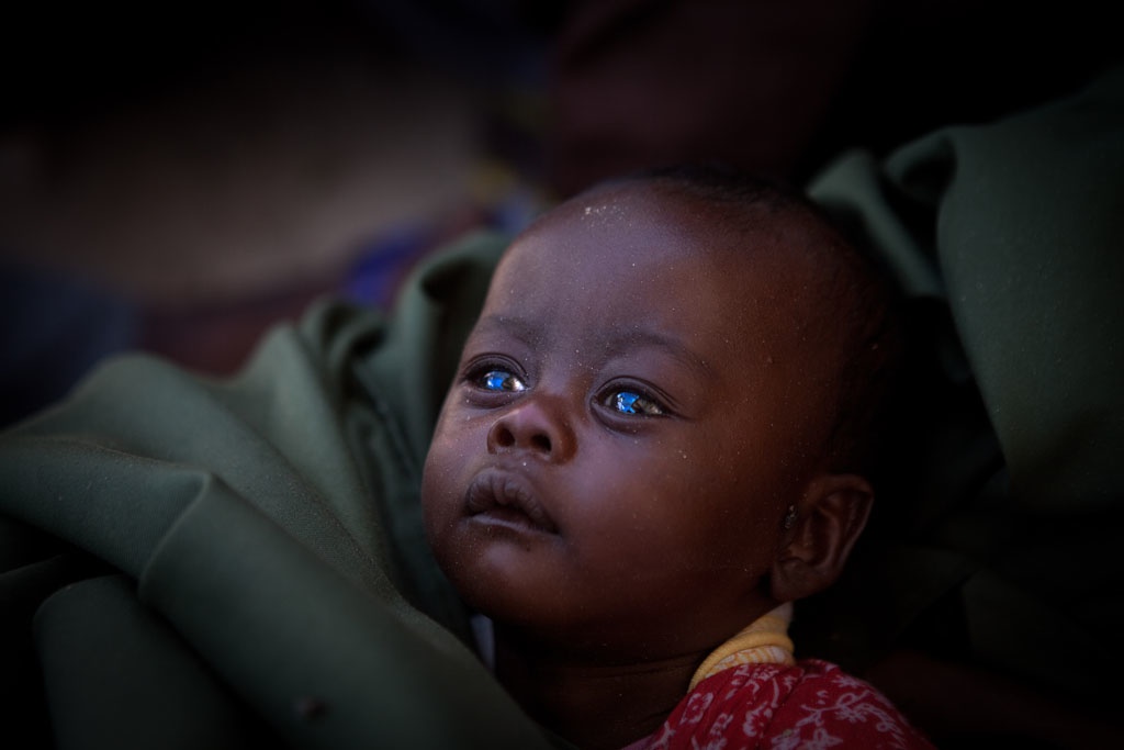 Is Somalia starving? - The World from PRX