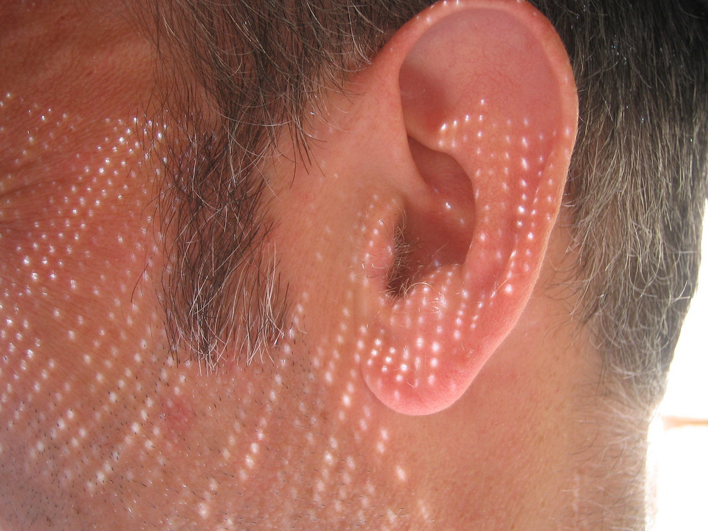 This new treatment could combat hearing loss by regenerating hair cells ...