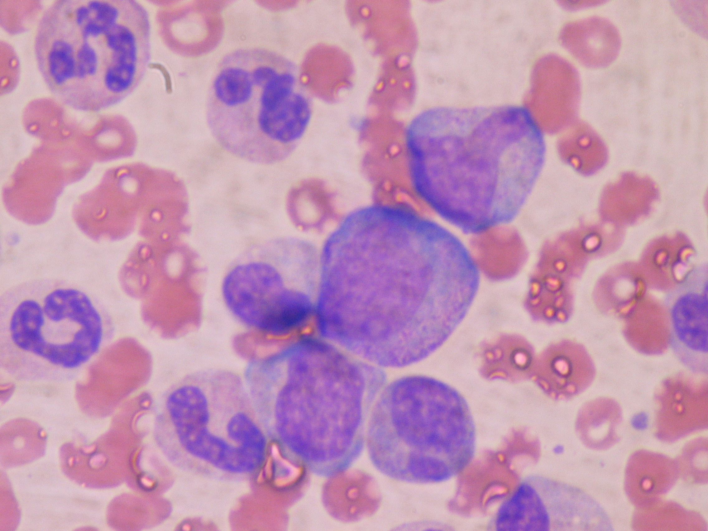 Blood-forming stem cells likely hold the key to curing many types of ...