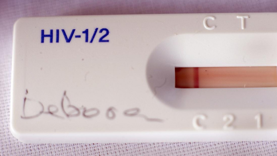 Australian Court Jails Hiv Man For Having Unprotected Sex The World From Prx