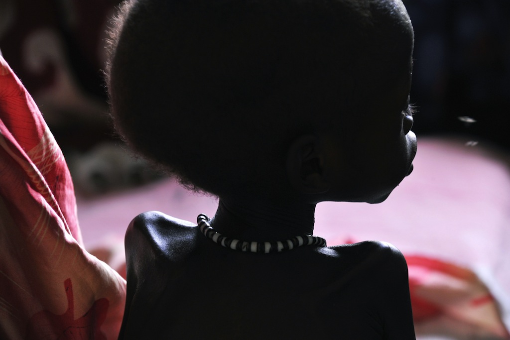 Famine being used as a weapon of war - The World from PRX