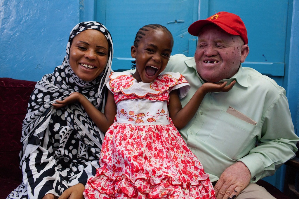 Congo: Albino rapper N'Kashh prepares his debut album - The World from PRX